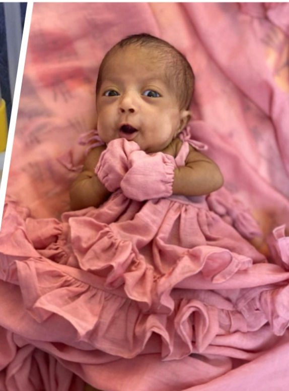 Baby born with 550 grams weight survives beating odds