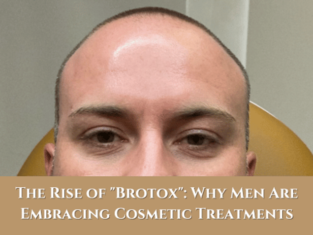 Brotox: Why Men Choose Cosmetic Treatments