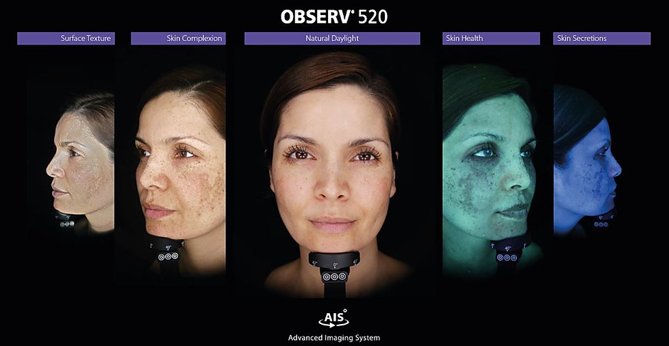 Observ 520x Skin Anaylsis | nuyu