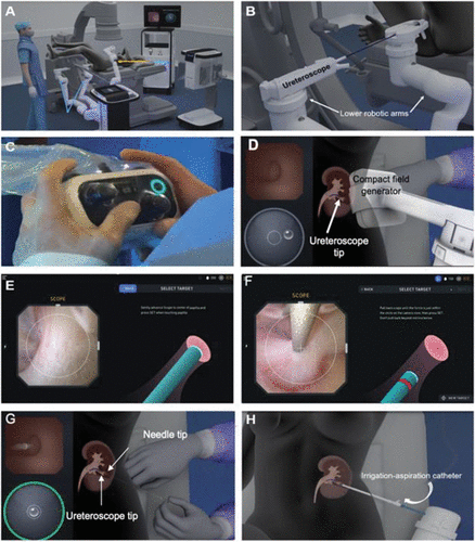 Endolumenal Surgical Robots vs Endolumenal robots : The challenges