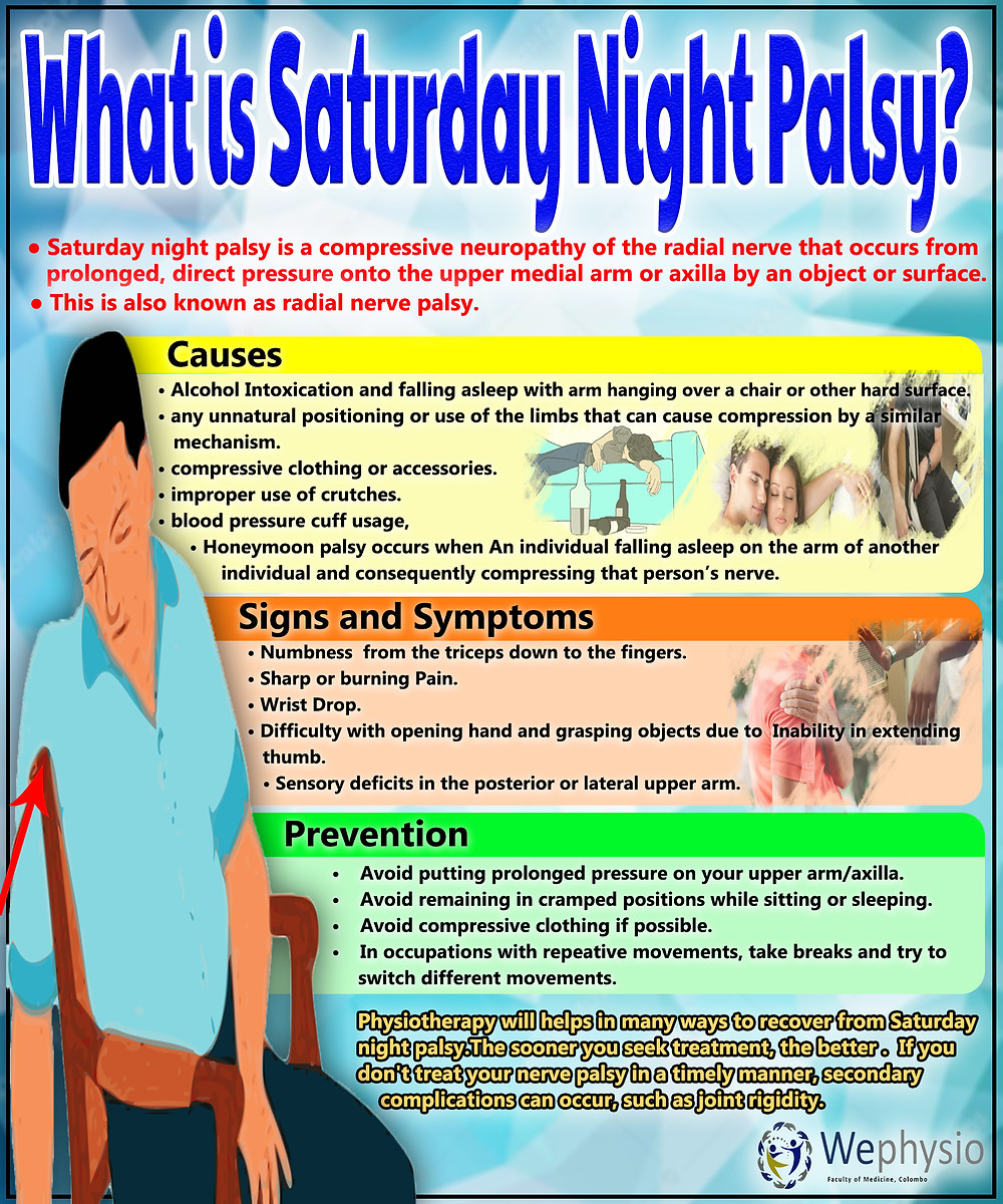 What Is Saturday Night Palsy what-is-saturday-night-palsy