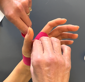 Intro to Hand Therapy | VHSF | Upper Limb & Hand Rehab