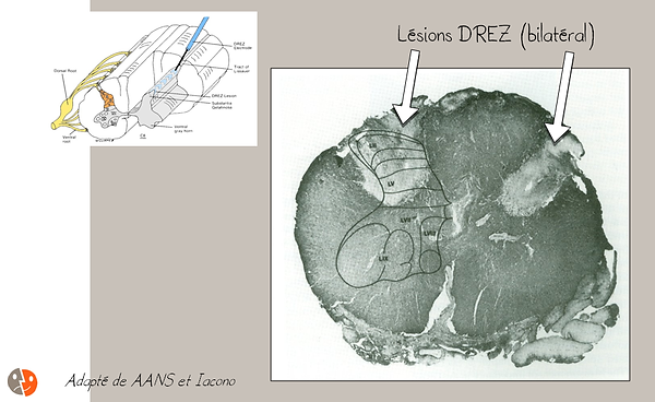 Drez | Vevey | Centre de la Douleur Riviera