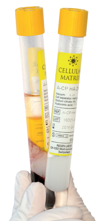 RegenLab PRP | Rejuvenate Face Clinic