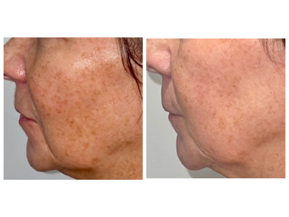 Gallery | DermaCare MD