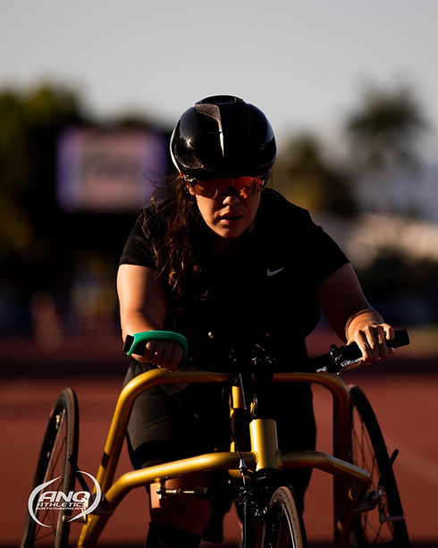 I AM AMY | Disability advocate