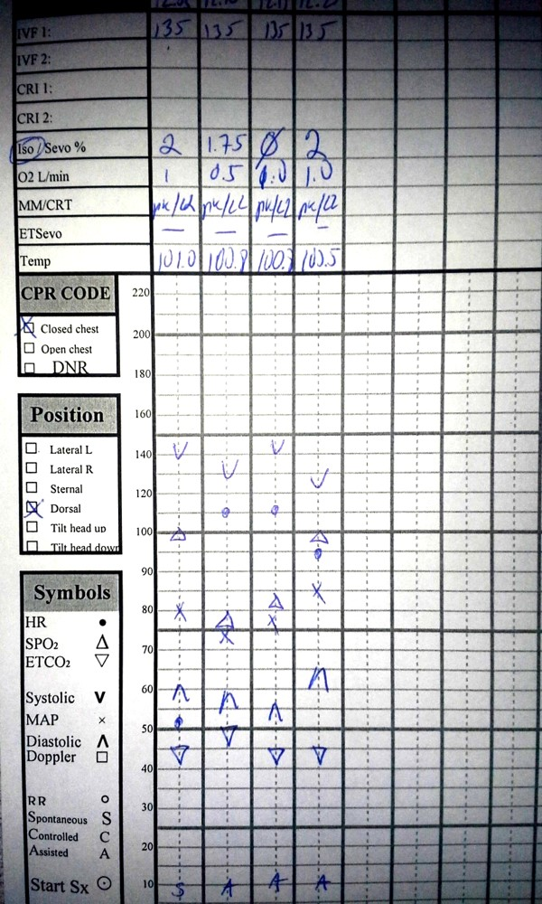 Anesthesia Records - Why Bother?