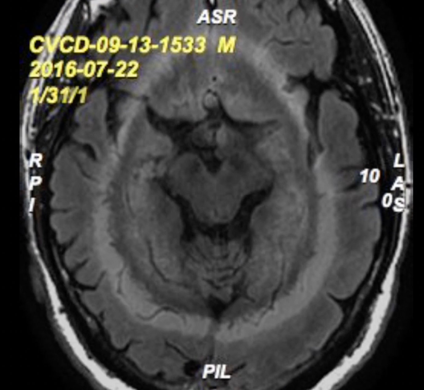 M.A.D.S. ART GALLERY | artwork. | Walnut Brain