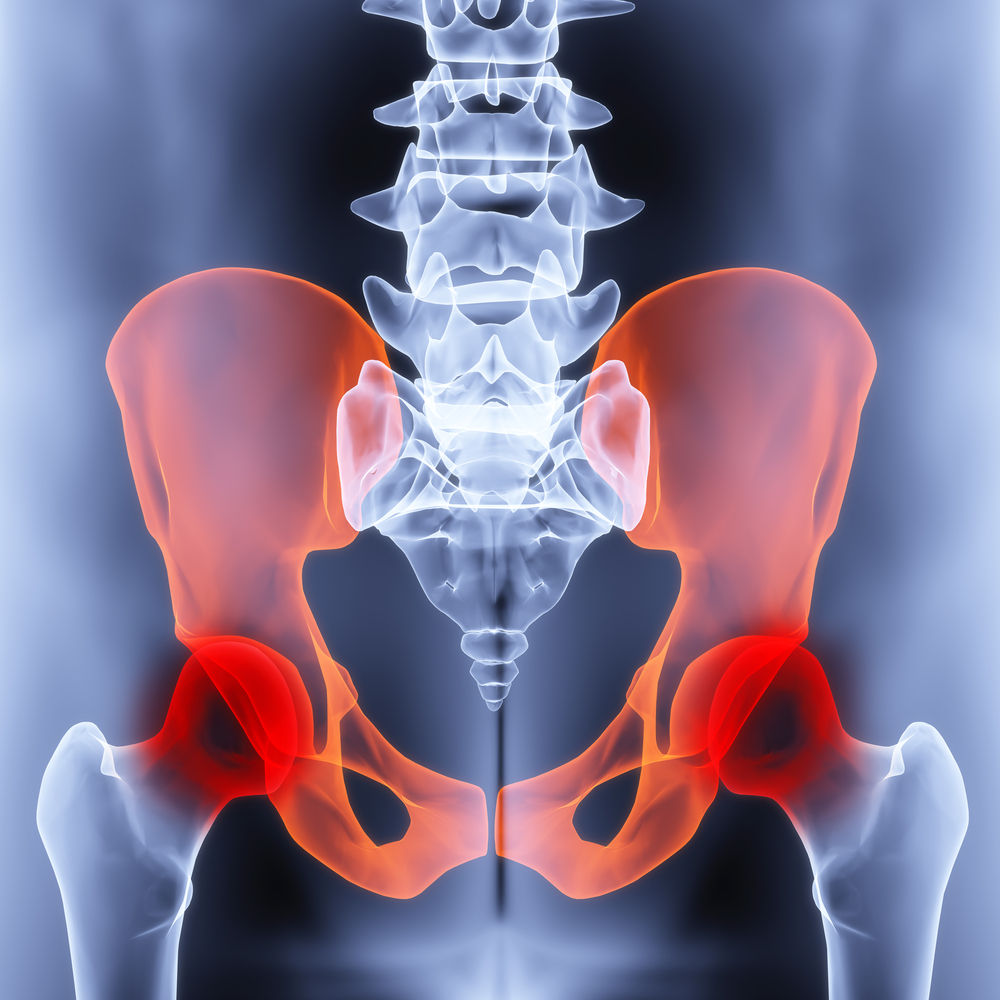 Groin pain - have you considered Osteitis Pubis?
