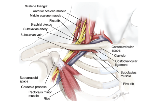 Comprendre et soulager sa névralgie cervico-brachiale en 5 exercices