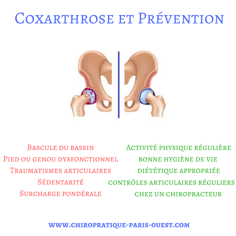Coxarthrose et Chiropraxie : Une Alternative à l'Opération