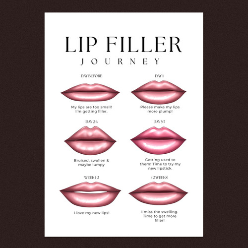 Lip Filler Journey Poster | Ninety Nine Design