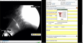 DMX Documentation | Digital Motion X-ray