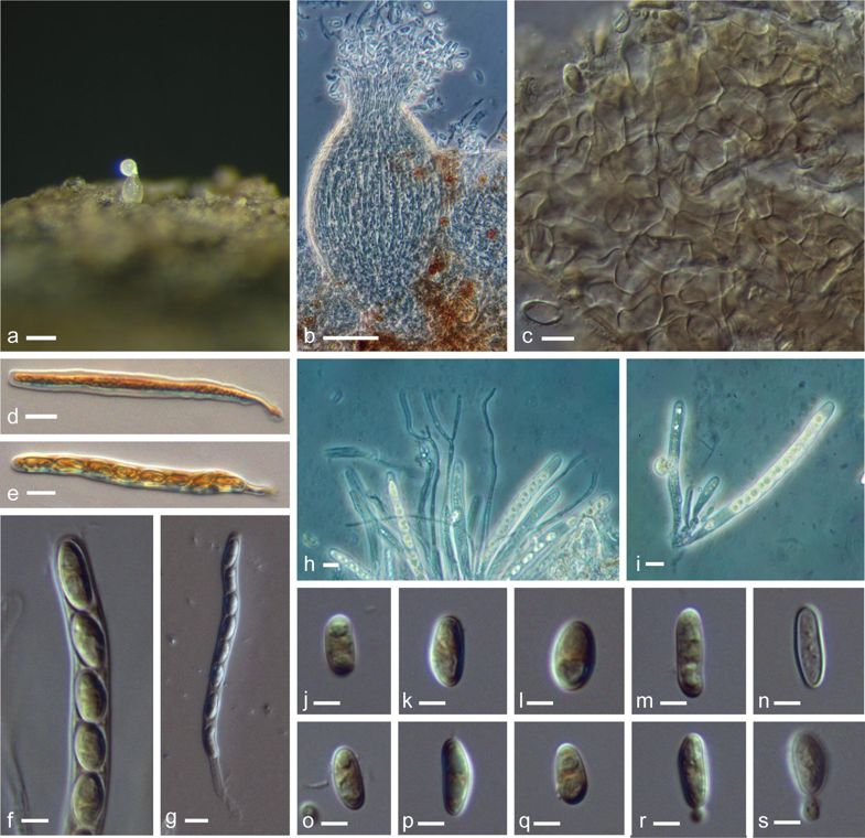 Marine fungi - why not?