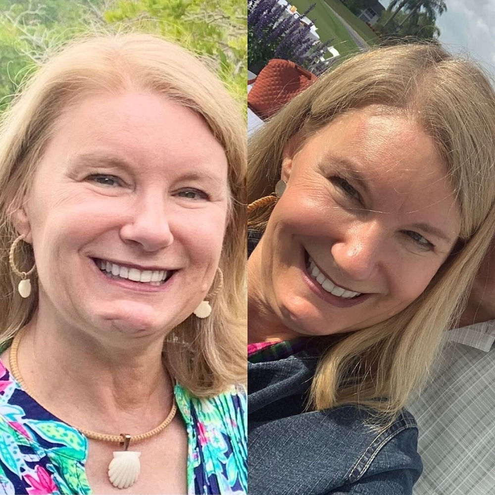 Post-Menopause, This Woman Lost 6 Pounds With Intermittent Fasting And ...