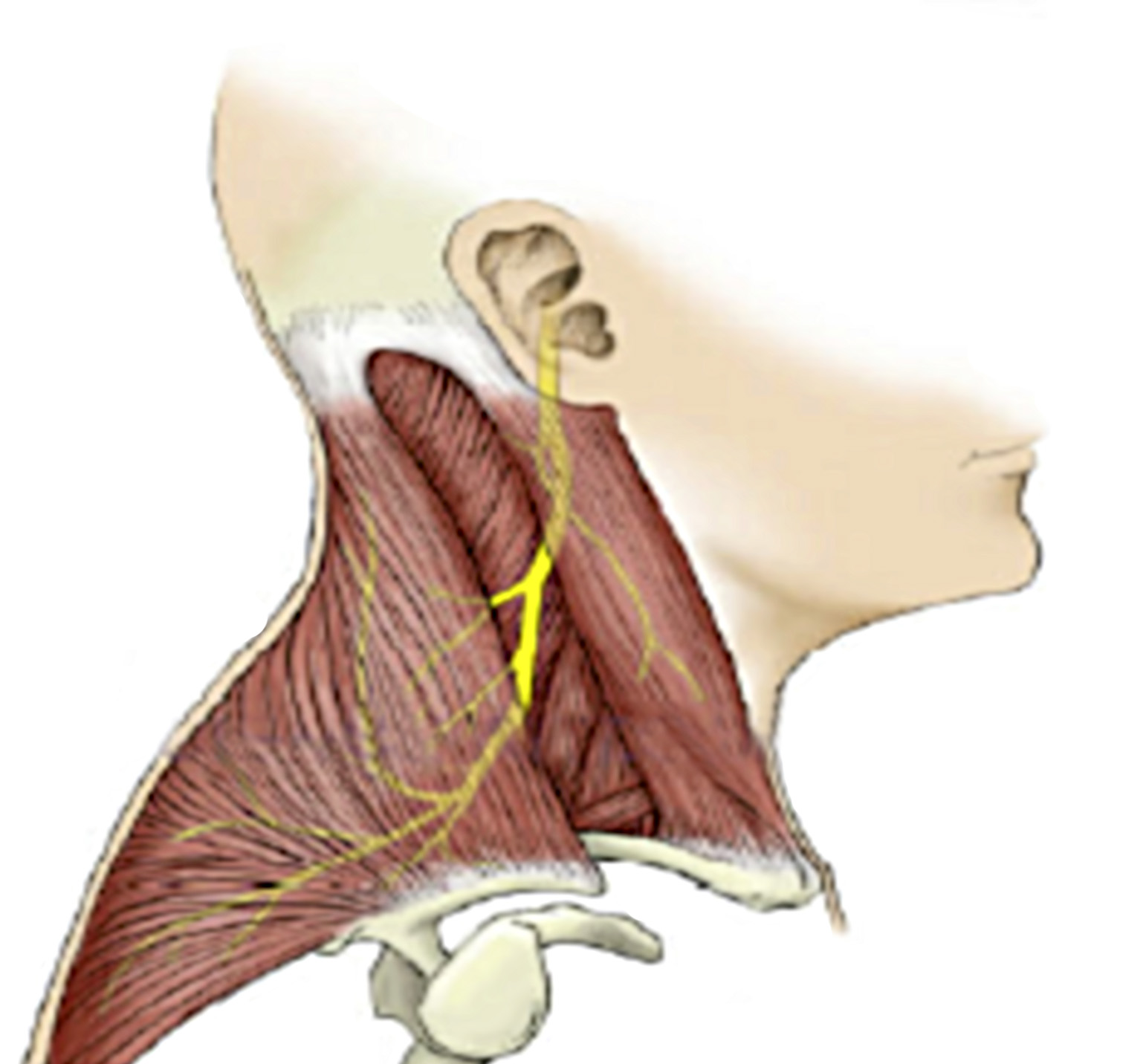 Doenças do Nervo Acessório; Doenças do XI Nervo Craniano; Doenças do XI ...