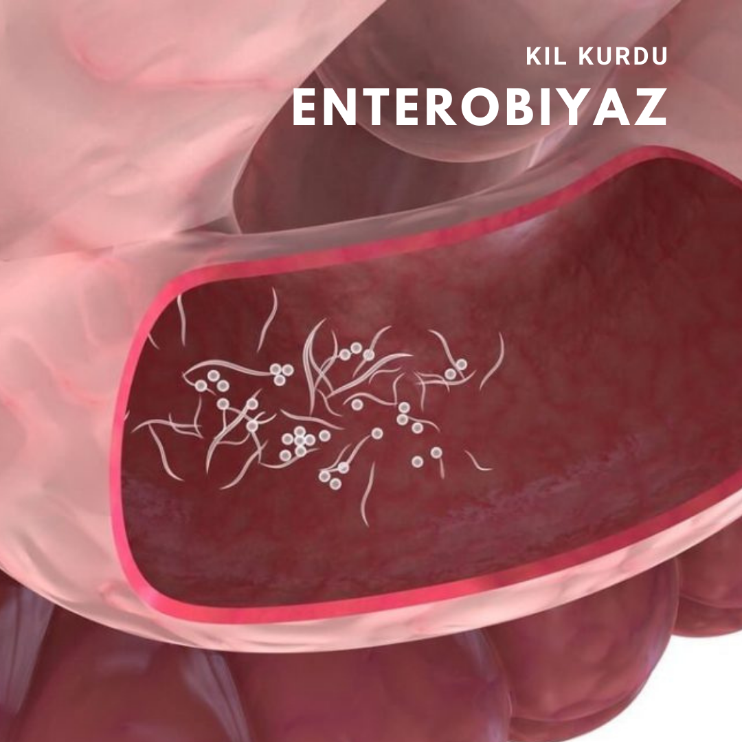Kıl Kurdu (Enterobiyaz)