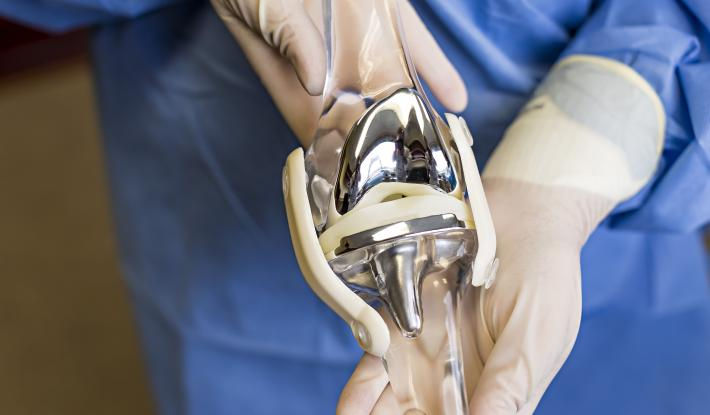 When is it time for a knee or hip replacement?