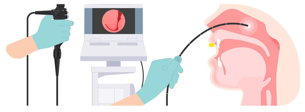 Fibronasolaringoscopia | Belo Horizonte - MG