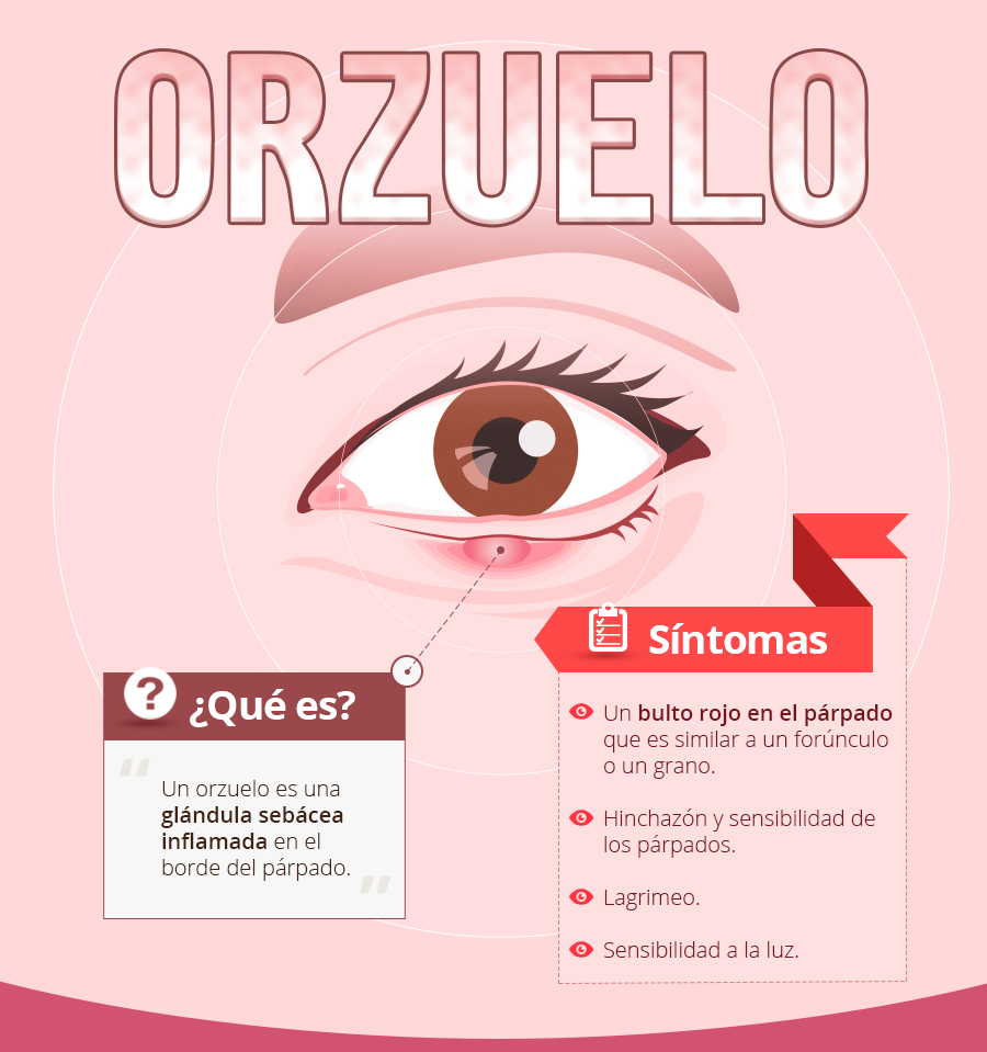 orzuelo.html