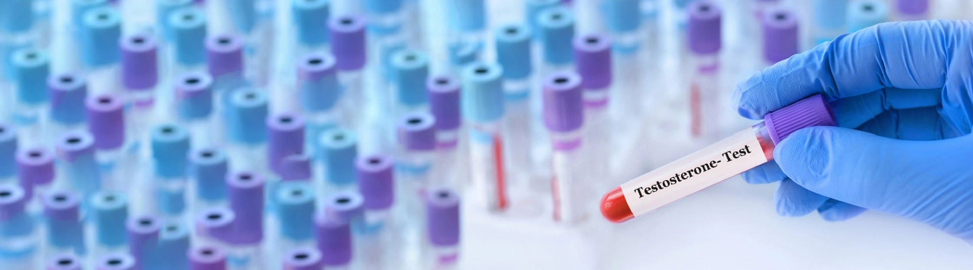 Can Long-Term Opioid Use Cause Low Testosterone Levels?