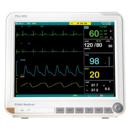 Monitor de Signos Vitales (6 Parámetros) | Tecnomedik