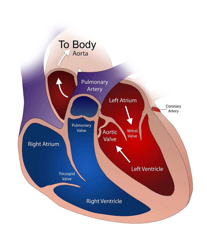 Hypertrophic Cardiomyopathy in an Athlete