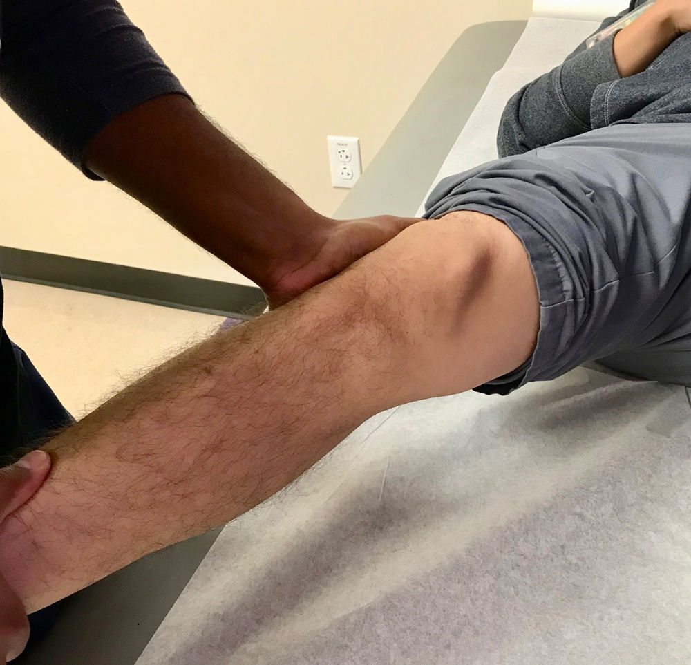 Isolated MCL (Medial Collateral Ligament) Injury