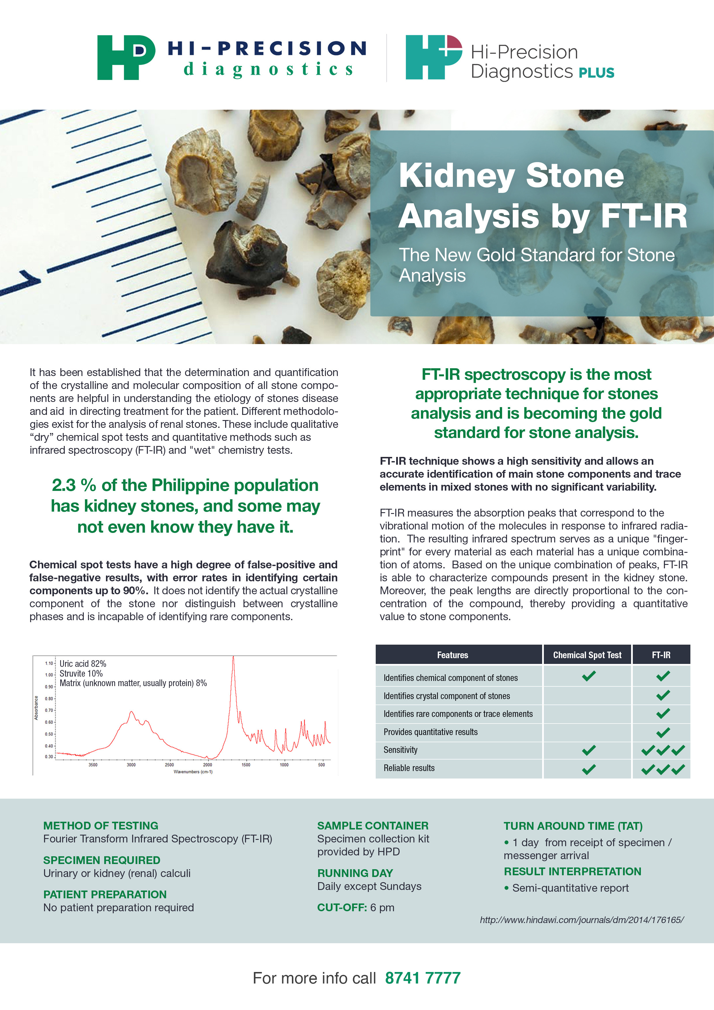 Kidney-Stone