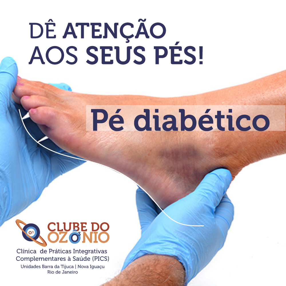 Dê atenção aos seus pés! Pé Diabético
