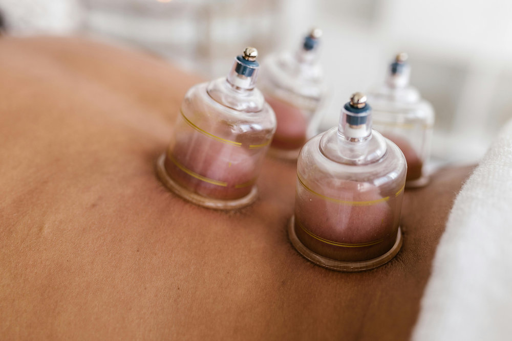 Cupping: How it Works and What to Expect