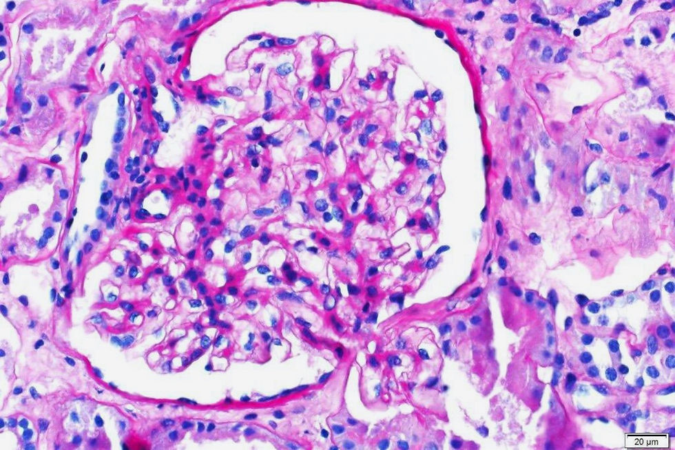 Nephrology | Kidney, Dialysis and Hypertension Specialists