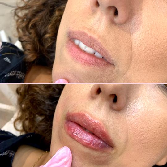Guide to First-Time Filler