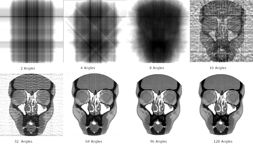 Nanox Imaging under the X-ray