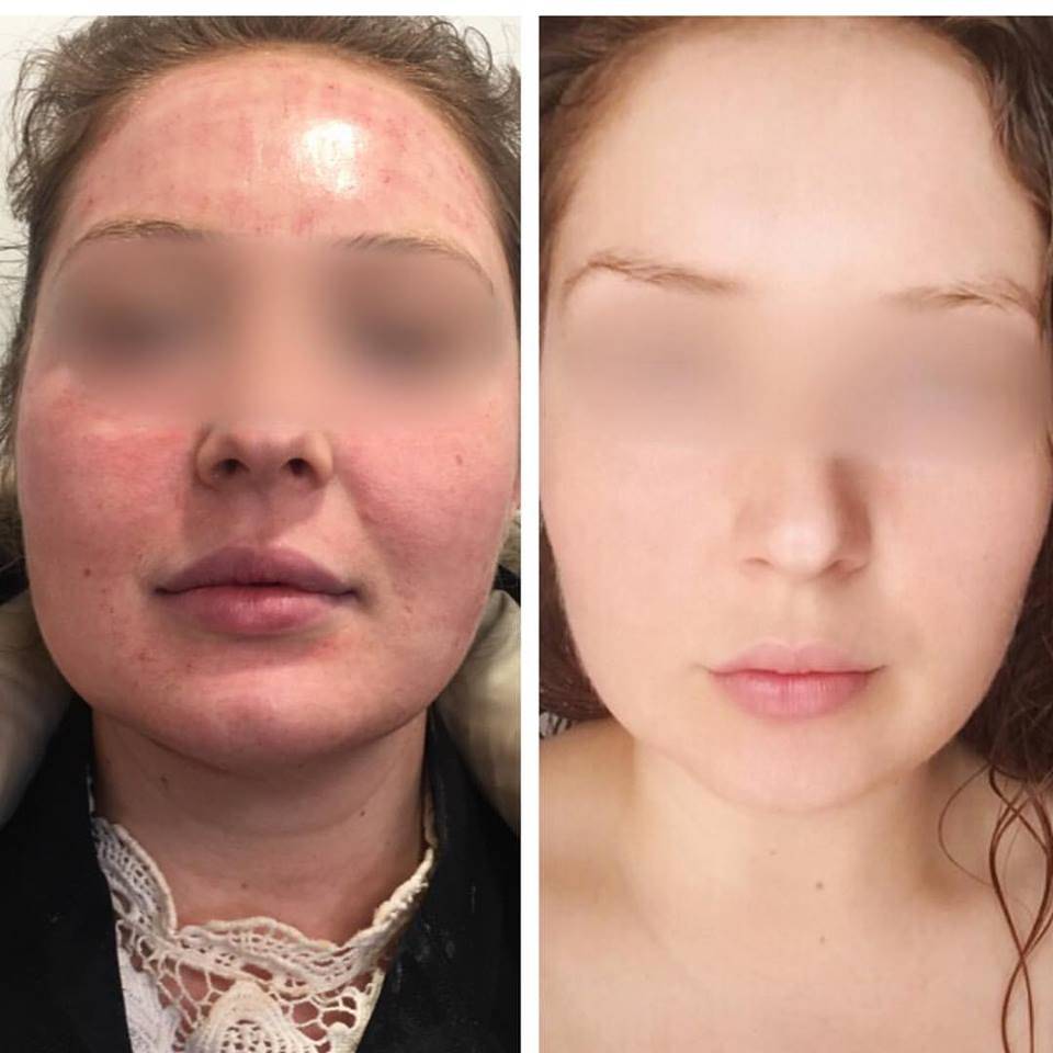 Refresh Medical Spa St. Louis MO