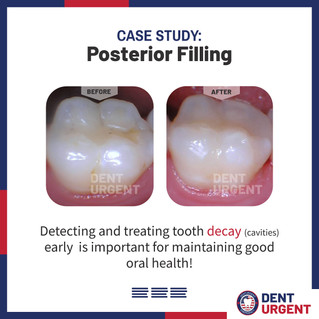 Emergency Dentist & Dental Implants in Dallas TX | DentUrgent