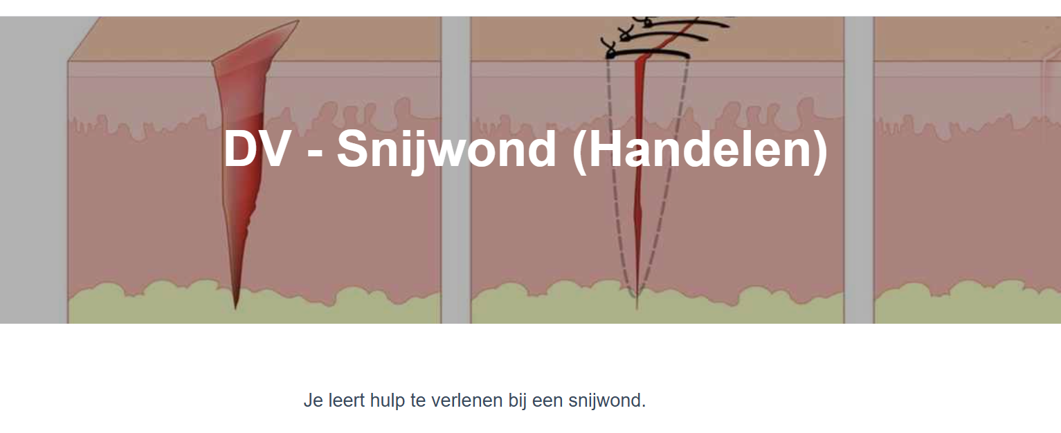 DV - Snijwond (Handelen)