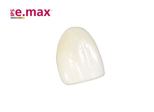 Dental Laboratory | Vitality Dental Arts | United States