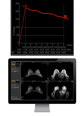 의료용 소프트웨어 - Merative/CAD | 씨엠피무역