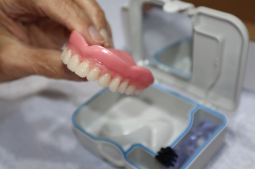 DENTURES NOW FULL UPPER DENTURE | Jessedent