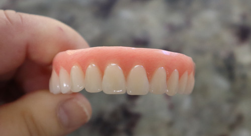 UPPER DENTURE /Horseshoe Dentures /Real Denture | Jessedent