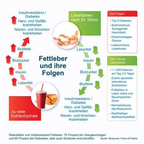 Die Fettleber und ihre Folgen: Wie Leberfasten helfen kann.