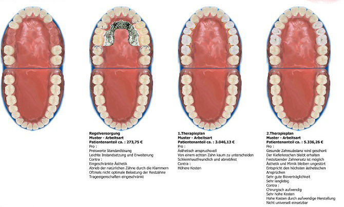 Die passende Zahnzusatzversicherung finden