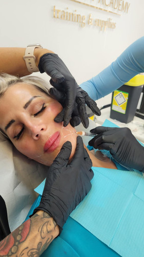 Foundation Dermal Fillers, Wrinkle Reduction and Complications ...