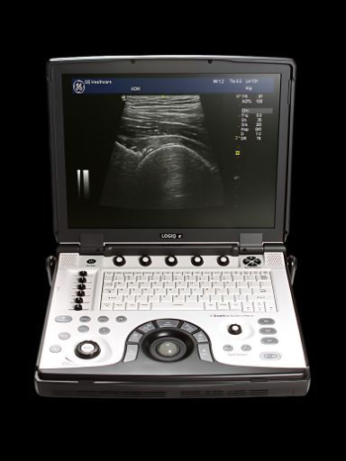 GE Logiq Totus Ultrasound Machine for Sale | Standard Ultrasound