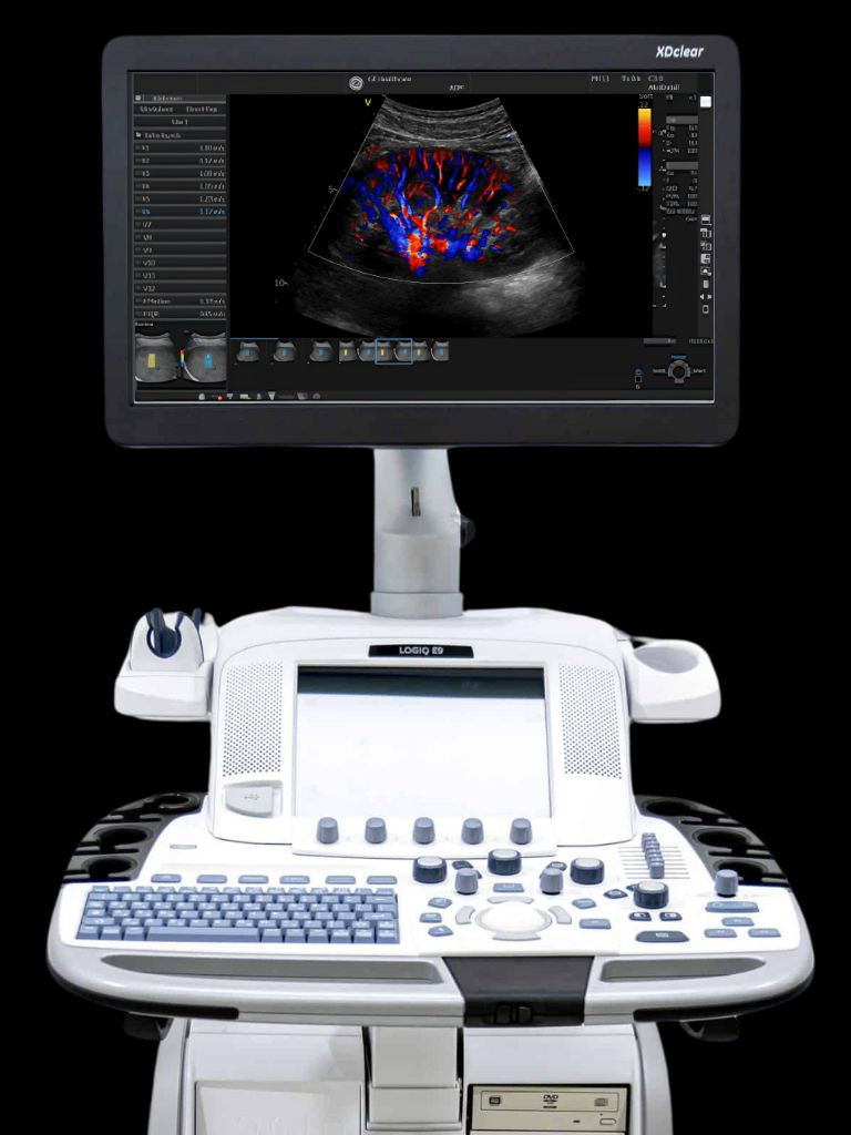 GE Logiq E9 Ultrasound Machine