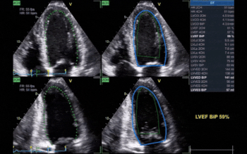 GE Vivid E95 Ultrasound Machine for Sale | Standard Ultrasound