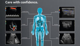 GE Ultrasound Feature LVO Contrast | Enhanced visualization for cardiac ...