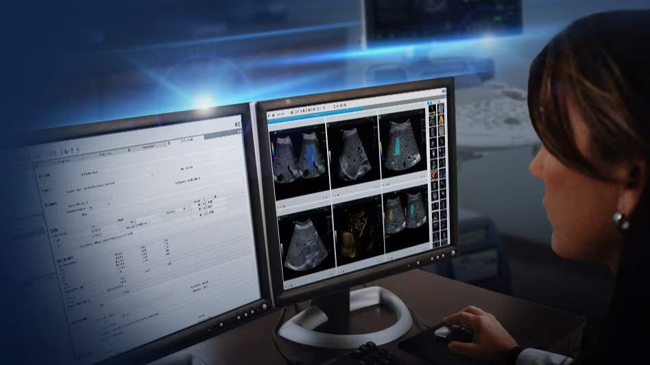 GE Ultrasound Feature EchoPAC Suite | Comprehensive PACS and Reporting ...
