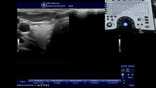 GE Ultrasound Feature Split Screen | Facilitates side-by-side image ...
